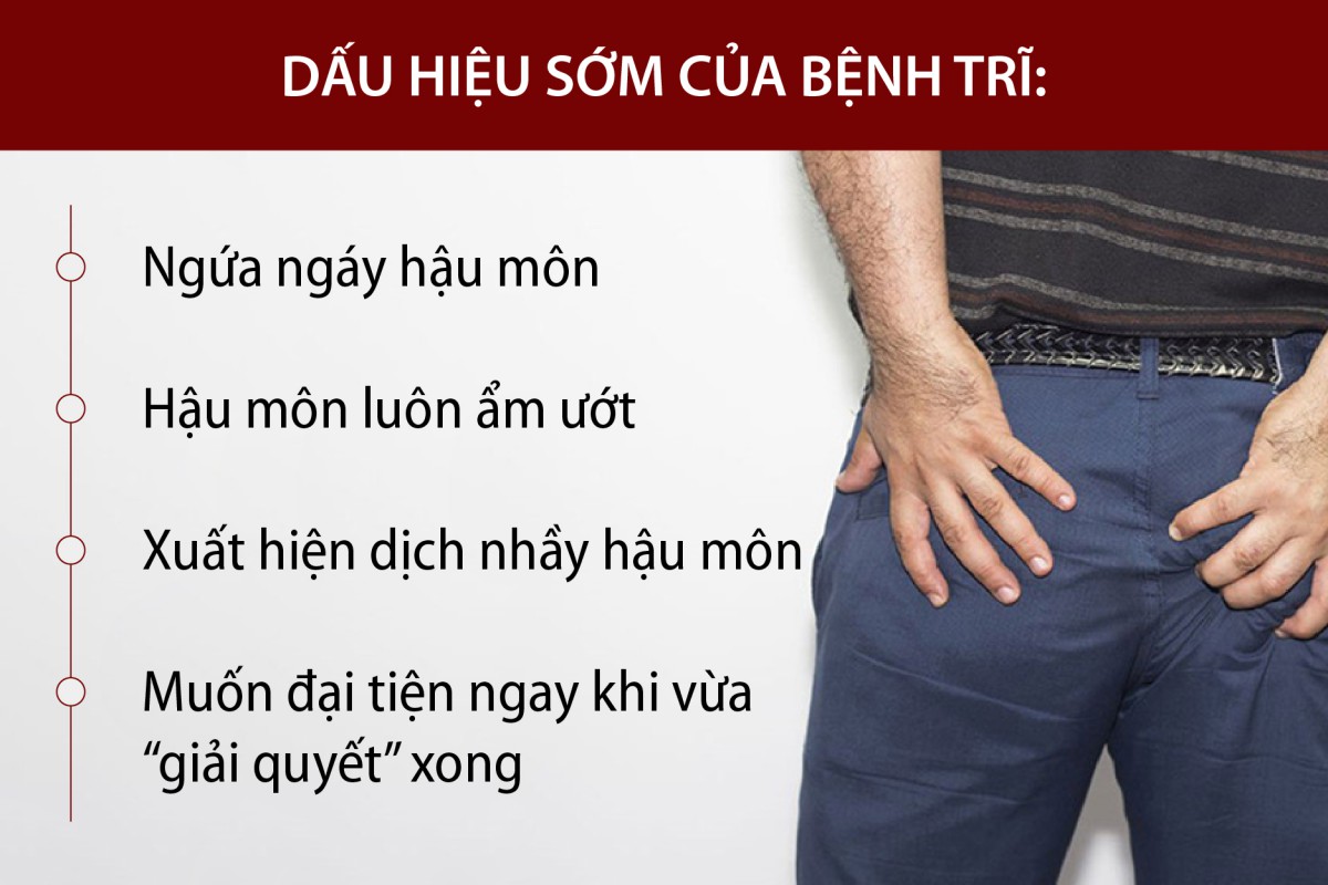 Bệnh trĩ là gì: Nguyên nhân, phân loại, triệu chứng và cách điều trị